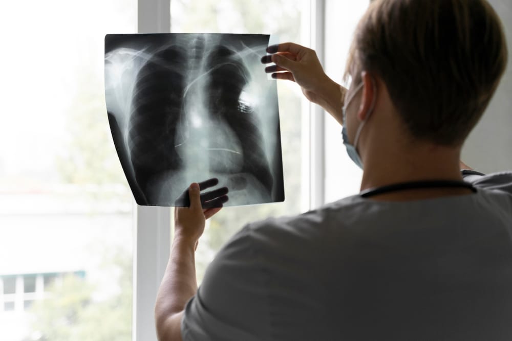 Entendendo a Tuberculose: Sintomas, Tratamento e Prevenção